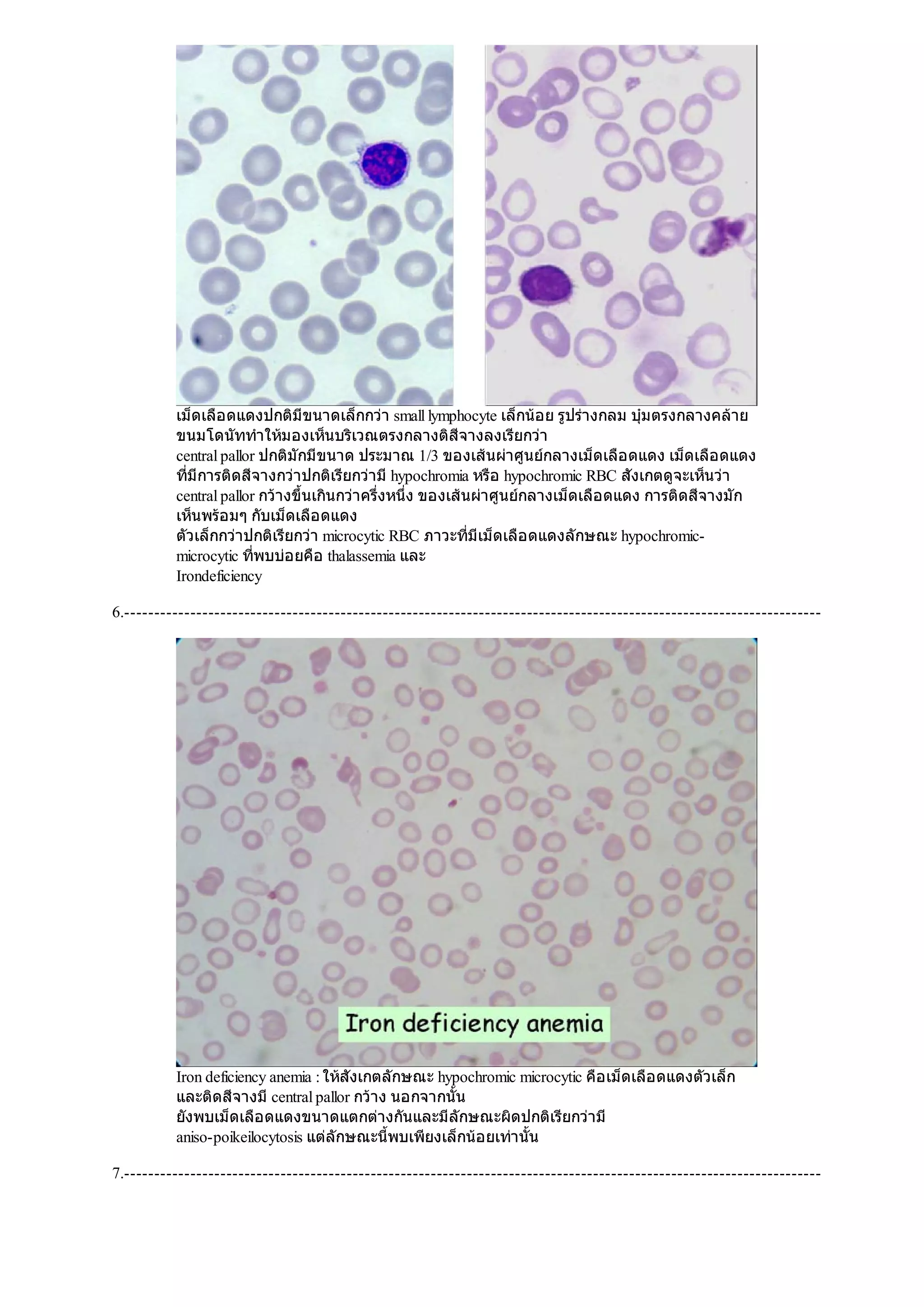 Peripheral blood smear | PDF