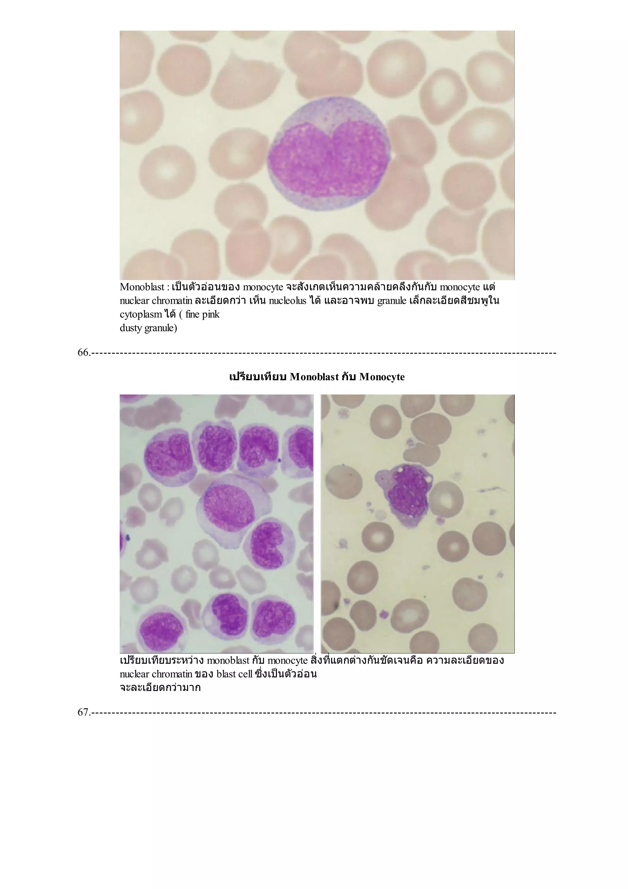 Peripheral blood smear | PDF