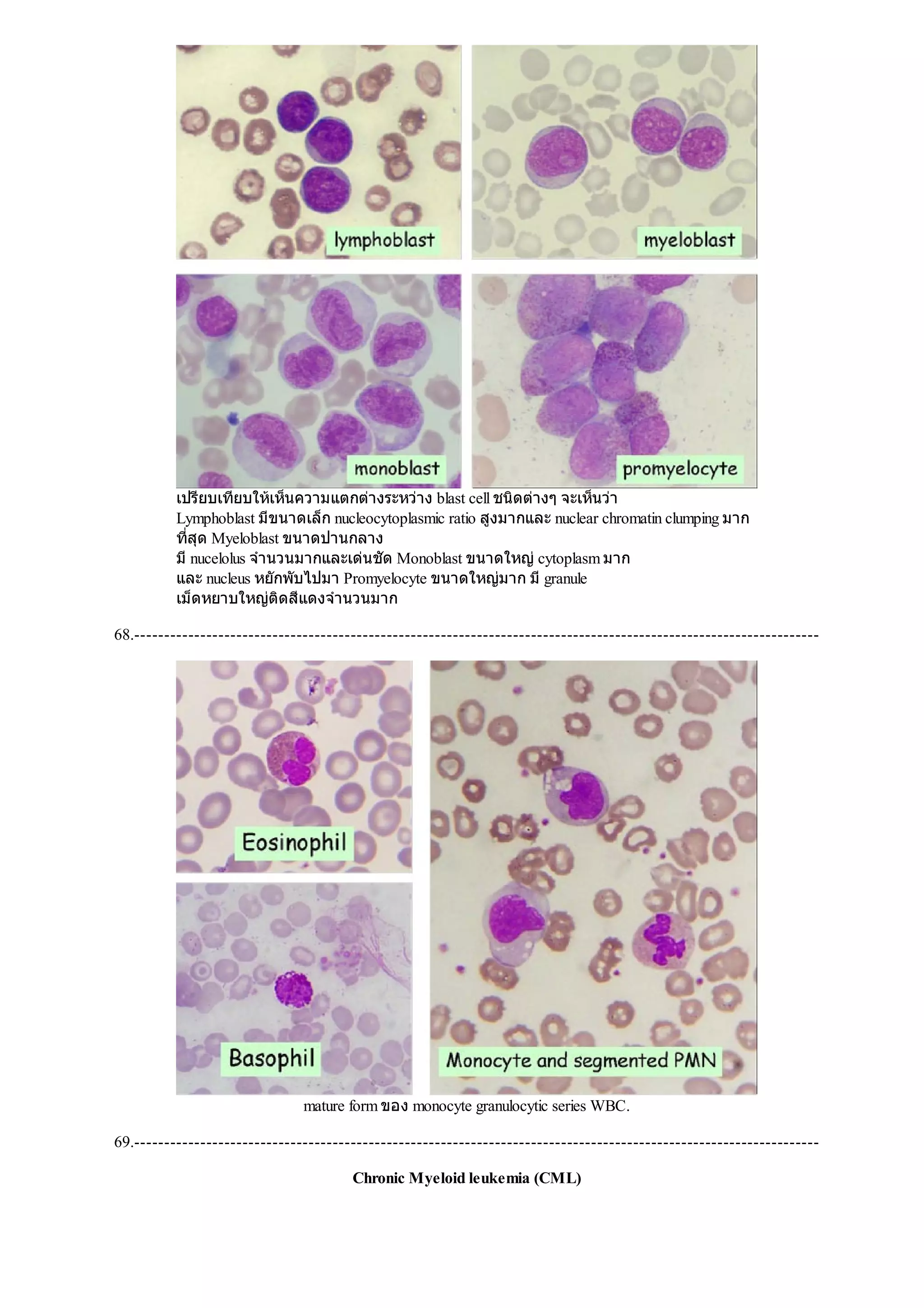 Peripheral blood smear | PDF