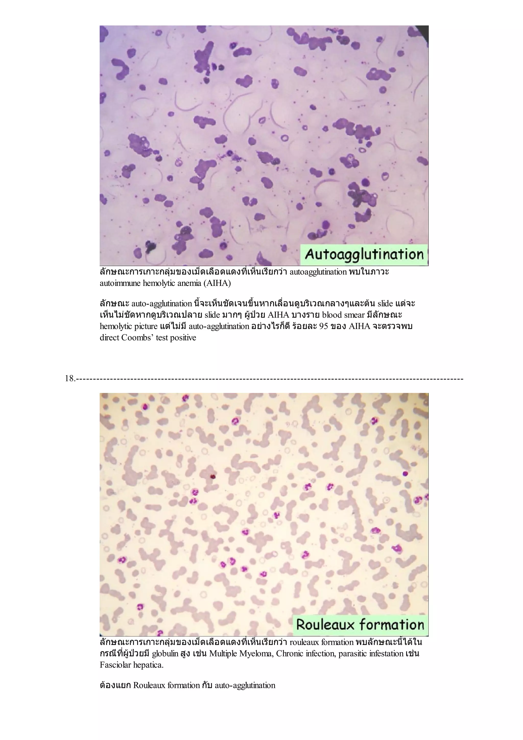 Peripheral blood smear | PDF