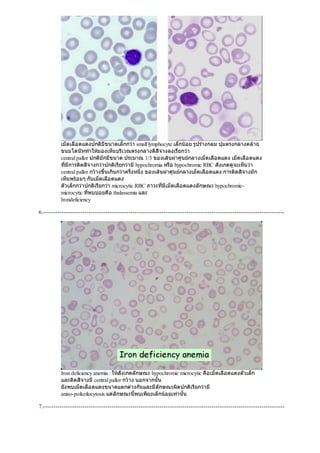 Peripheral blood smear | PDF
