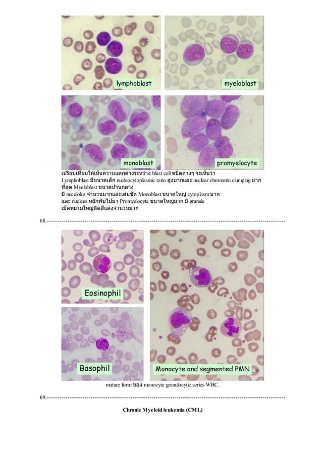 Peripheral blood smear | PDF