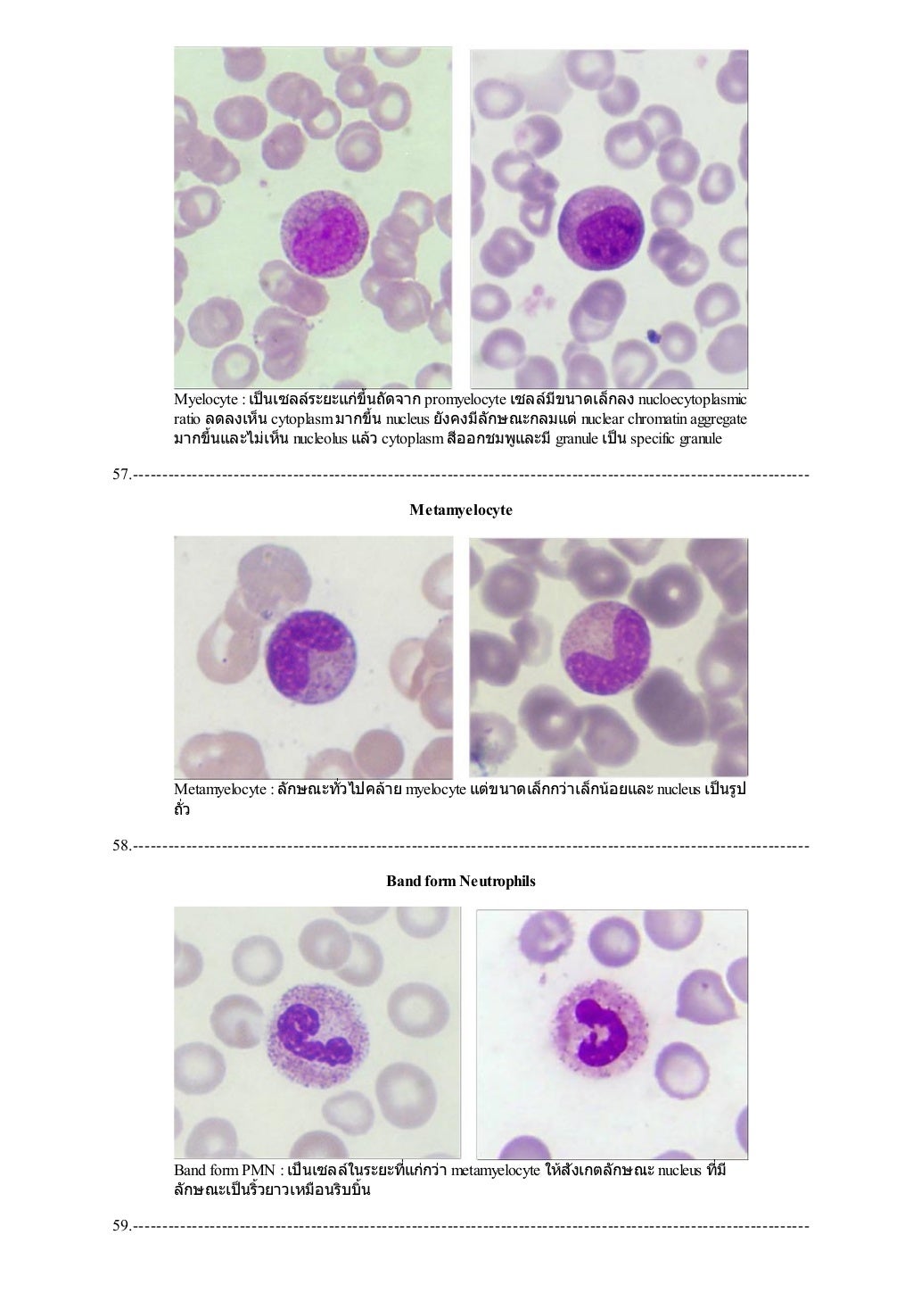 Peripheral blood smear