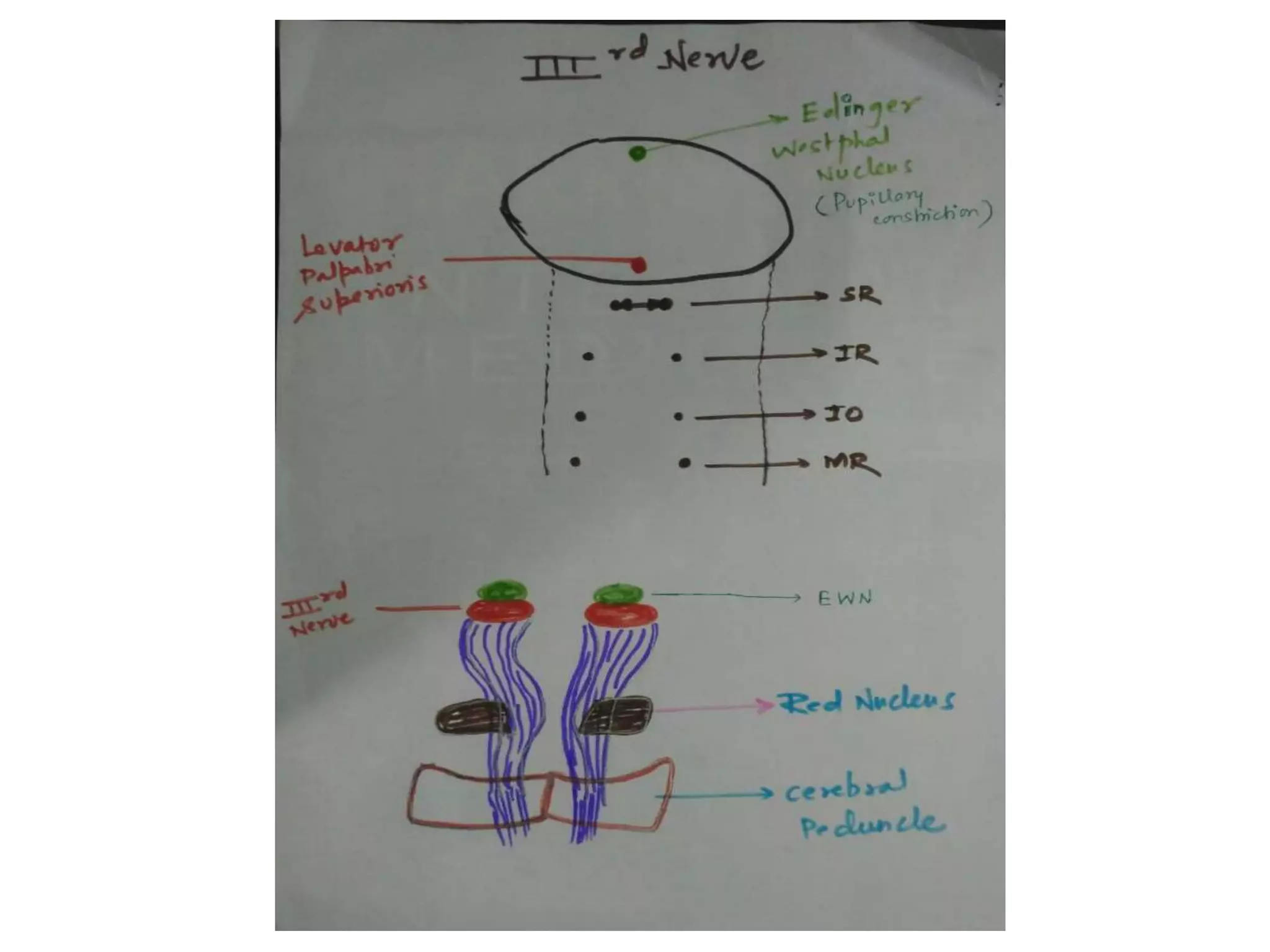 BRAINSTEM LESION INVOLVING 3rd,4th and 6th cranial nerve | PPTX