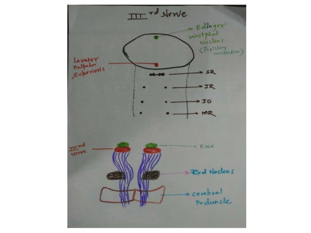 BRAINSTEM LESION INVOLVING 3rd,4th and 6th cranial nerve | PPTX | Eye ...