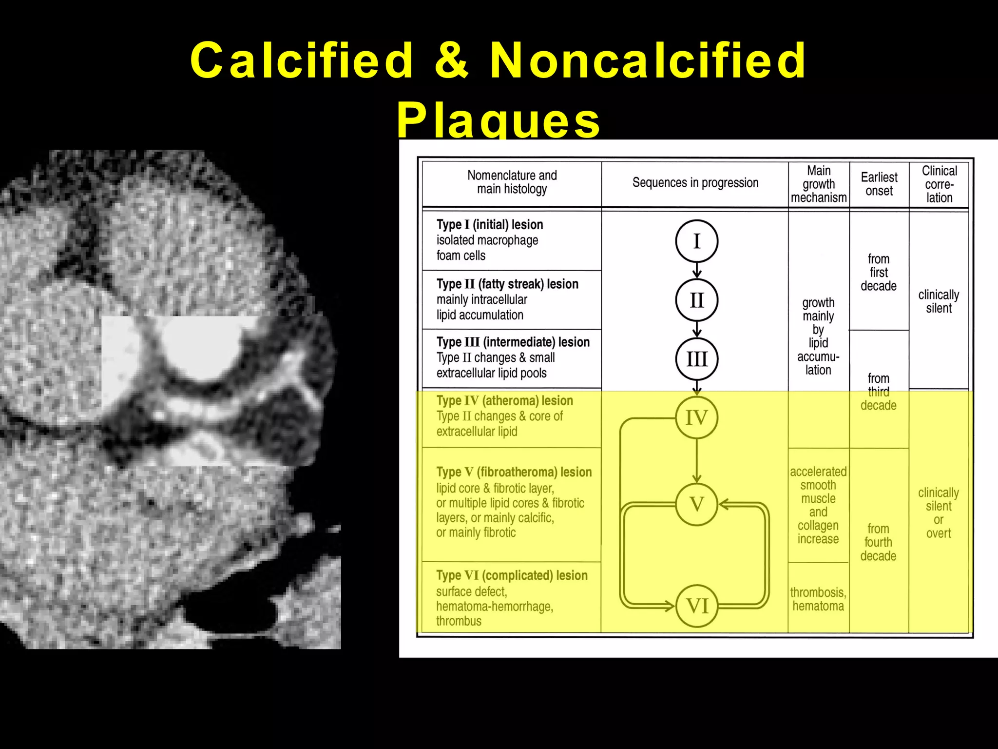 Accv porg | PPT | Heart and Cardiovascular Diseases | Diseases and ...
