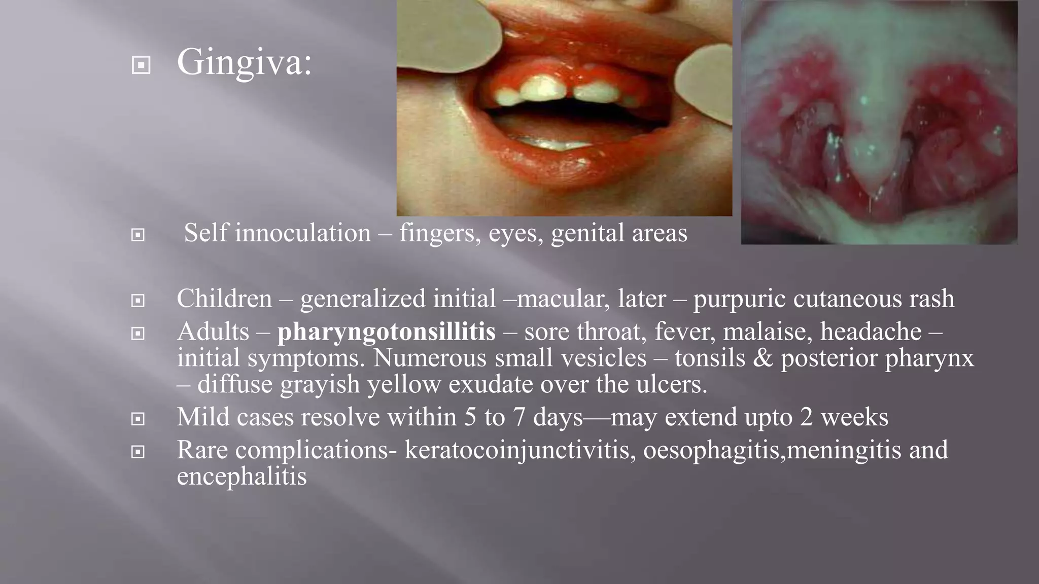 viral lesions of the oral cavity | PPTX