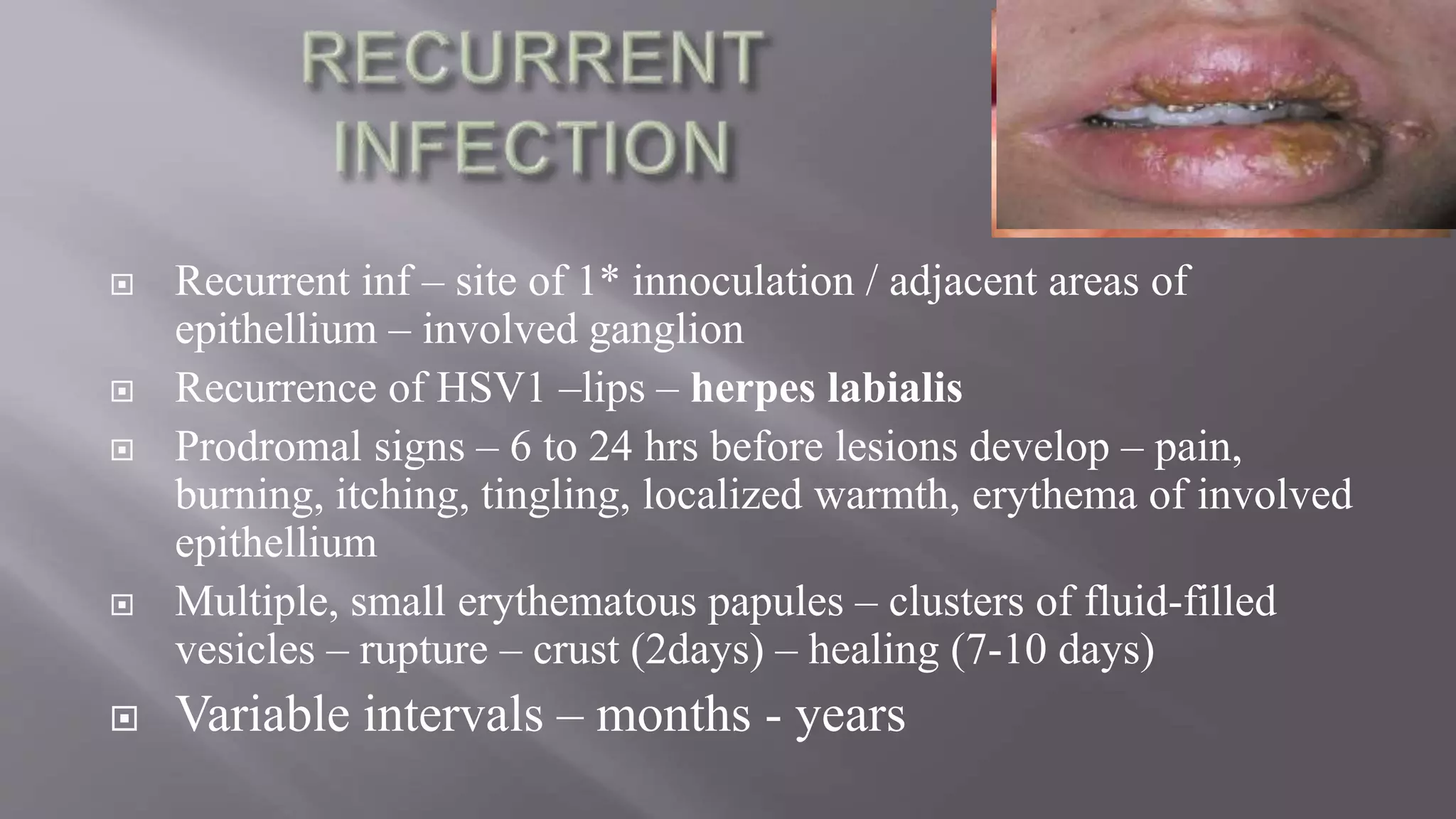 viral lesions of the oral cavity | PPTX