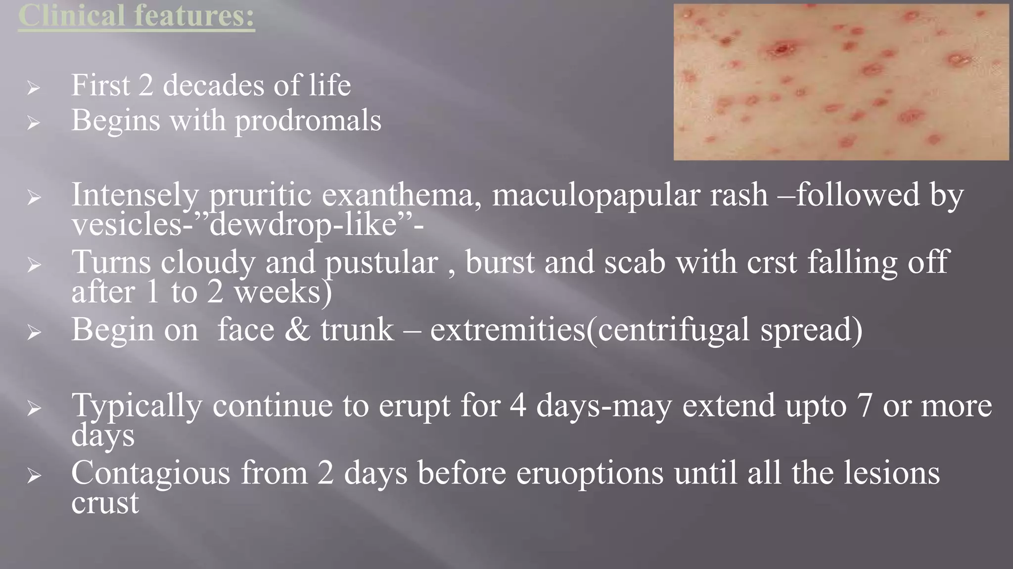 viral lesions of the oral cavity | PPTX