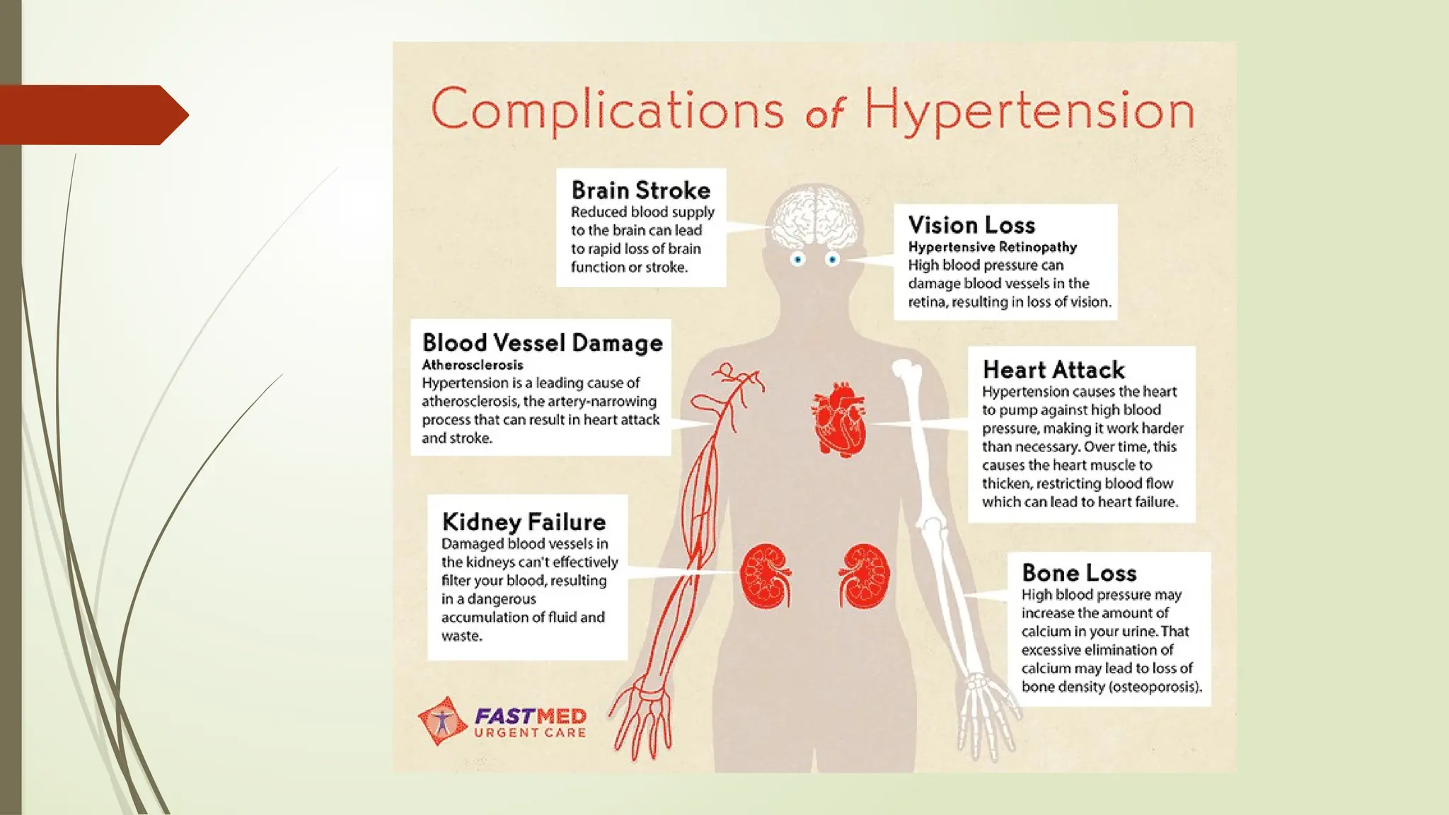 QUARTER ONE WEEK TWO ENGLISH 4 POWER POINT PRESENTATION | PPTX