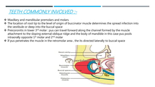 abscesses and phlegmonas of zygomatic , buccal | PPT