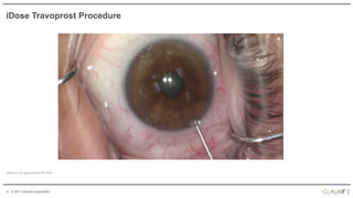 Q3 2017 ir presentation final | PPT