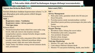 Asparina_18162004_(Meningitis).pptx