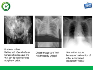 QA_and_QC_in_conventional_and_Digital_radiography_by_Joginder (1).pptx