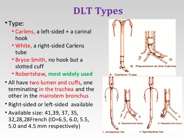 one lung ventillation, problem based learning