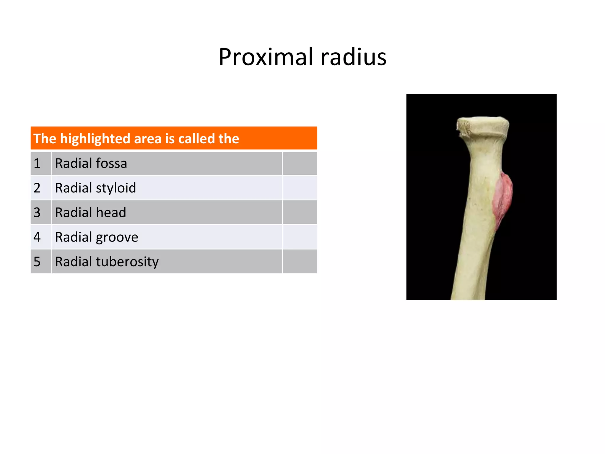 Exam Questions Radius | PPTX