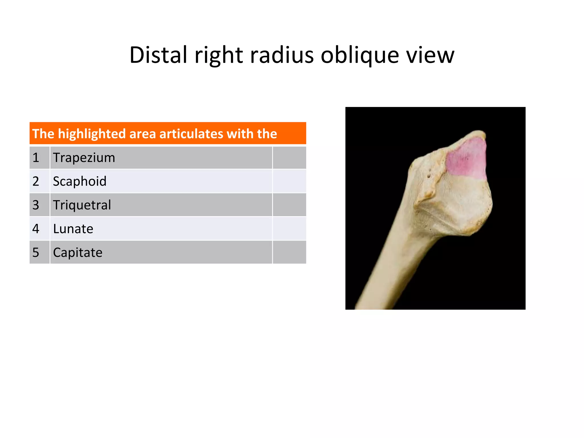 Exam Questions Radius | PPTX