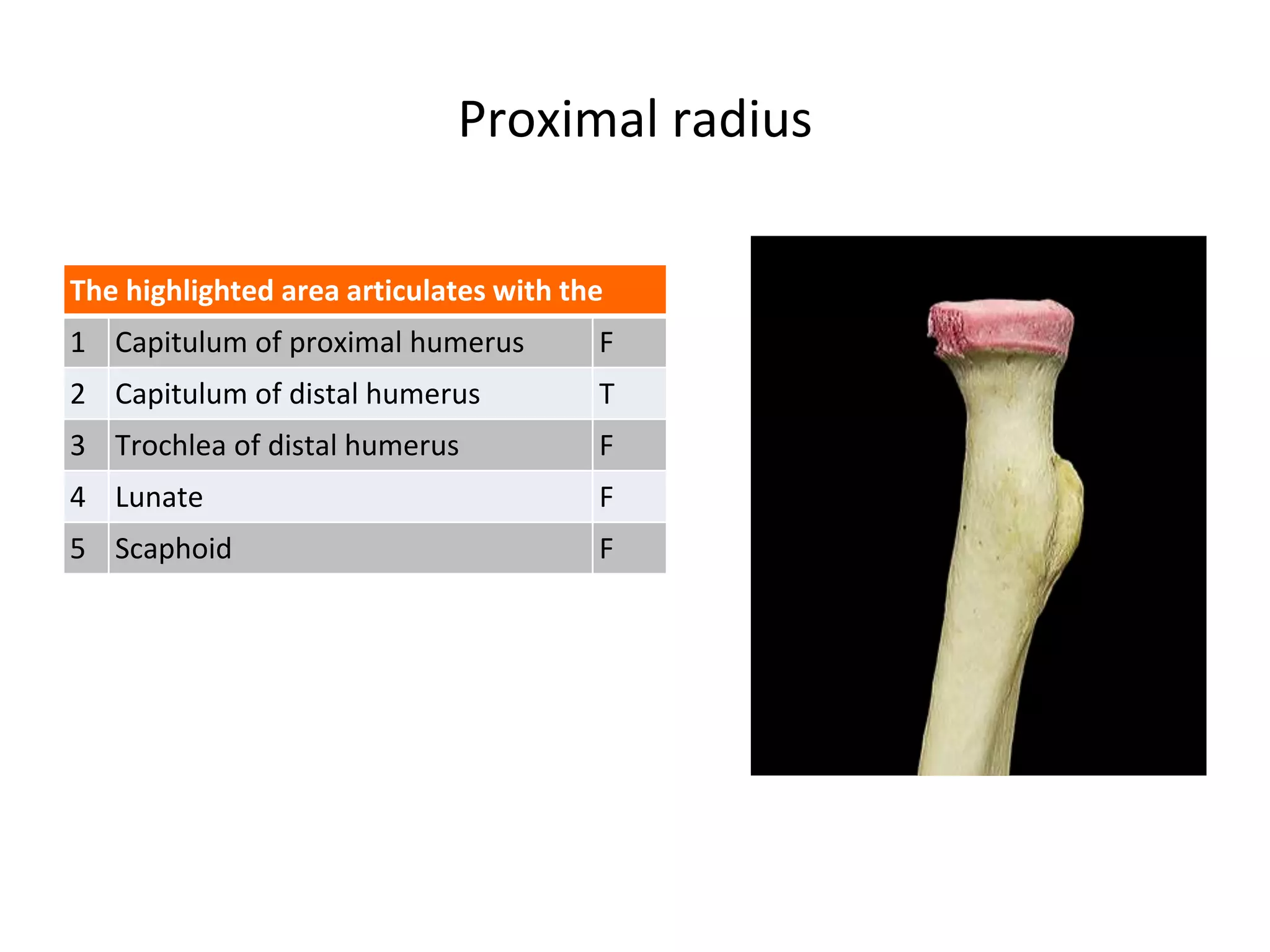 Exam Questions Radius | PPTX