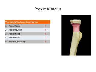 Exam Questions Radius | PPT