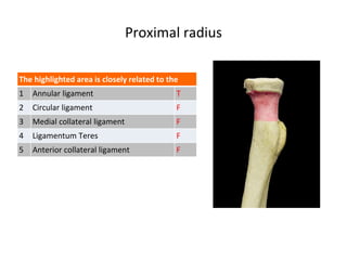 Exam Questions Radius | PPTX