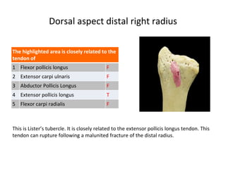 Dorsal Tubercle Of Radius Bone