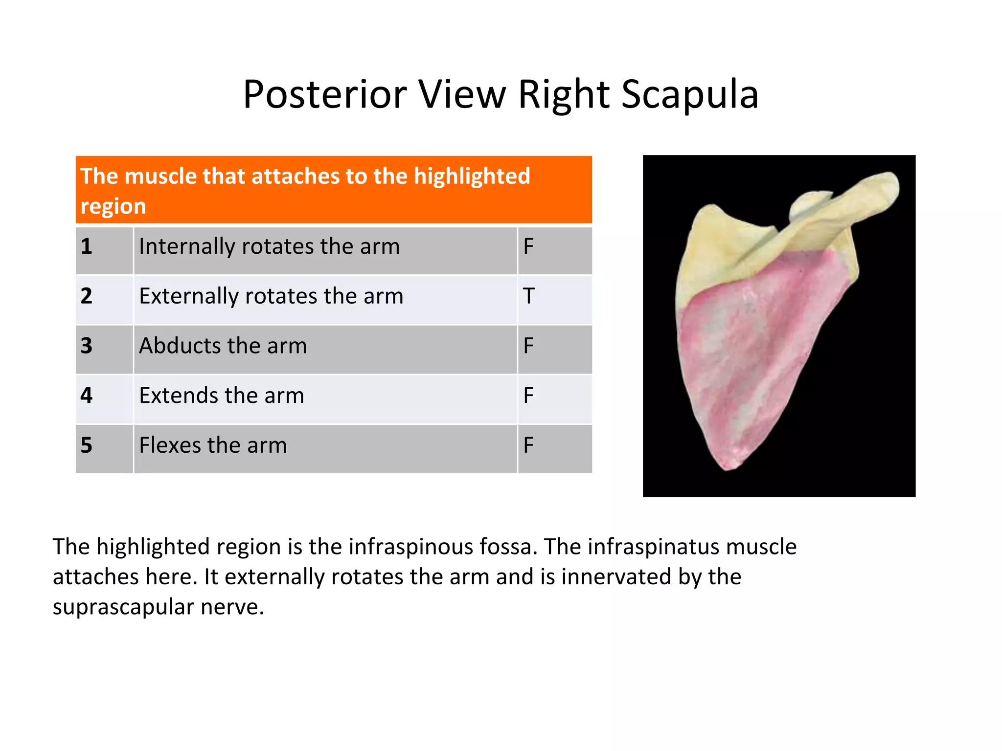 Exam Questions Scapula | PPTX