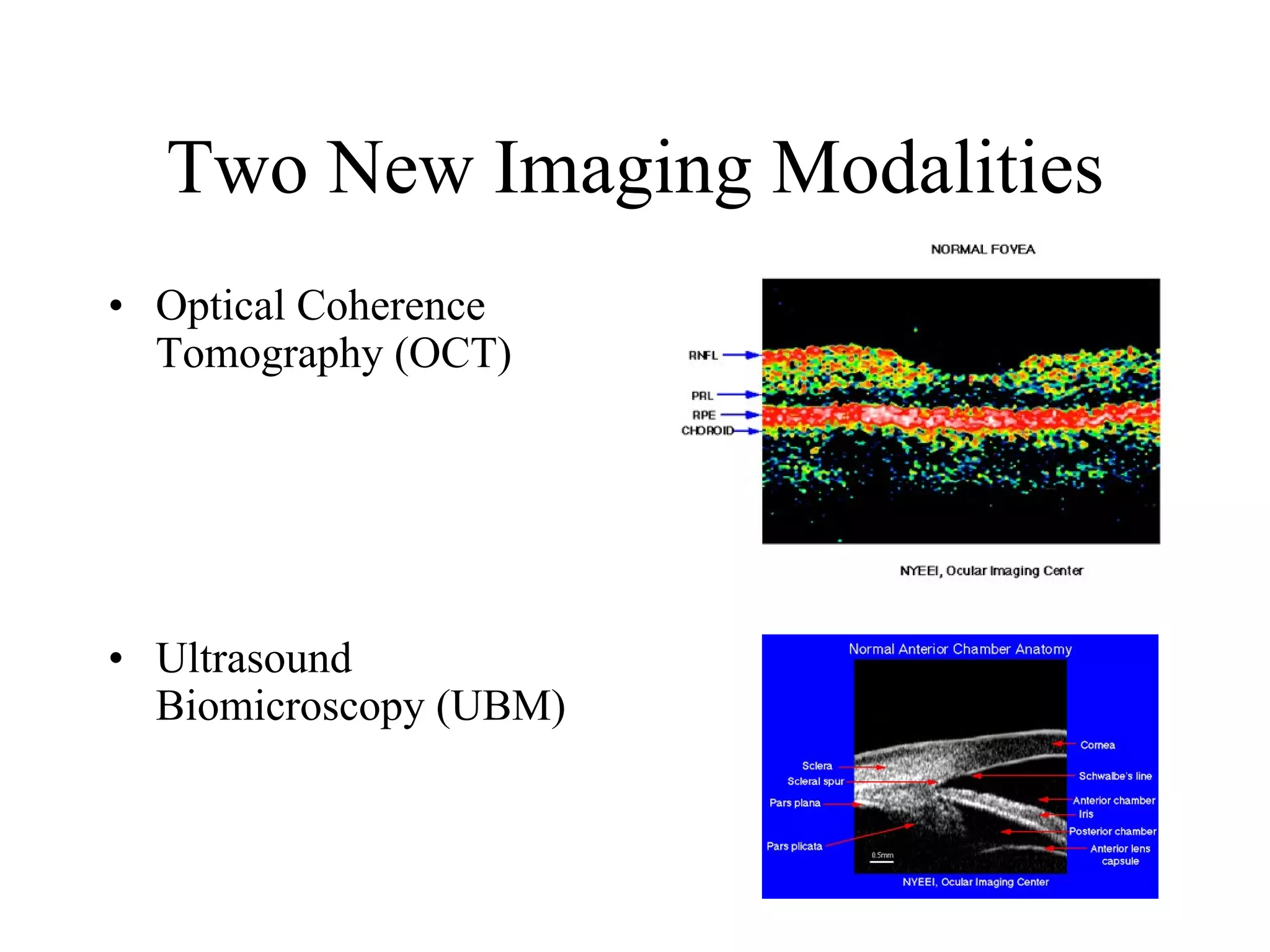 ultrasound biomicroscopy of the eye.ppt