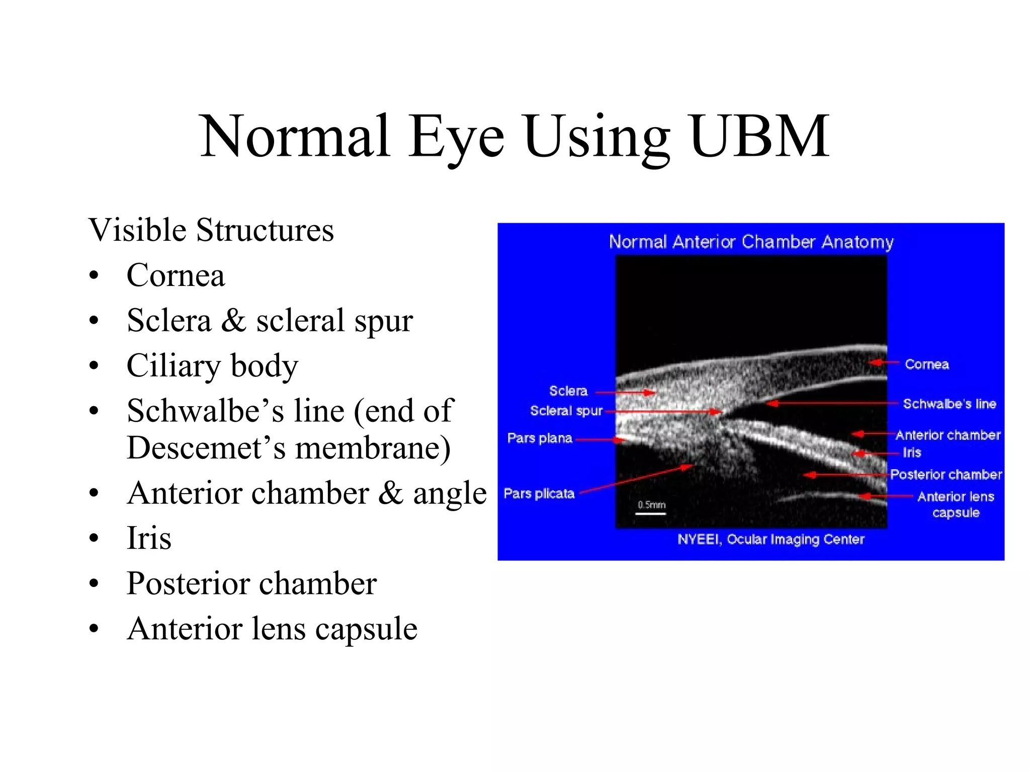 ultrasound biomicroscopy of the eye.ppt