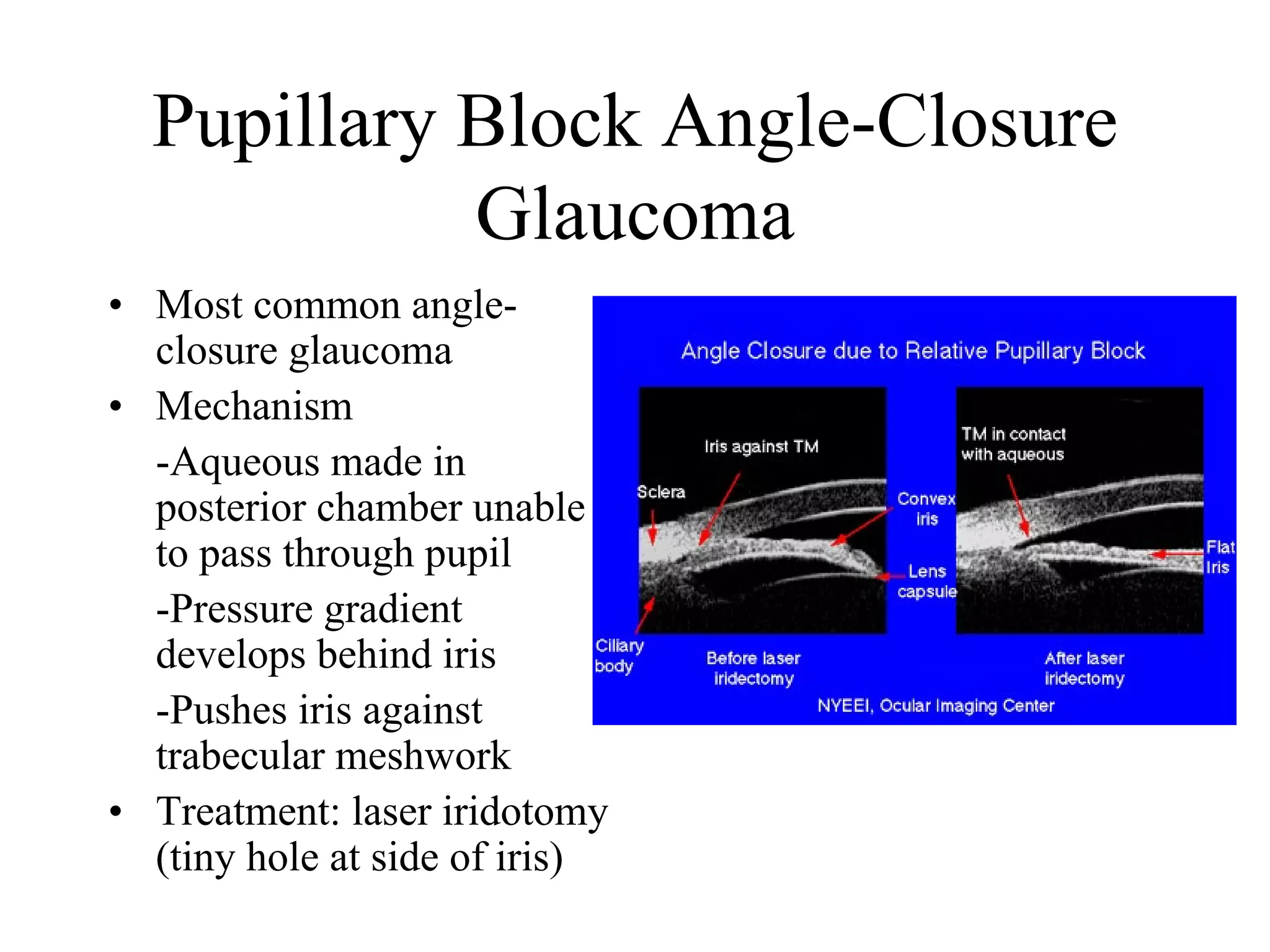 ultrasound biomicroscopy of the eye.ppt