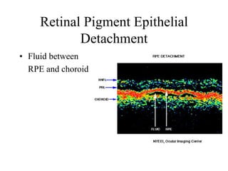 ultrasound biomicroscopy of the eye.ppt