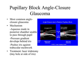 ultrasound biomicroscopy of the eye.ppt
