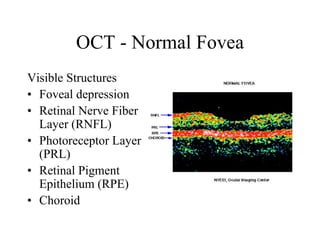 ultrasound biomicroscopy of the eye.ppt