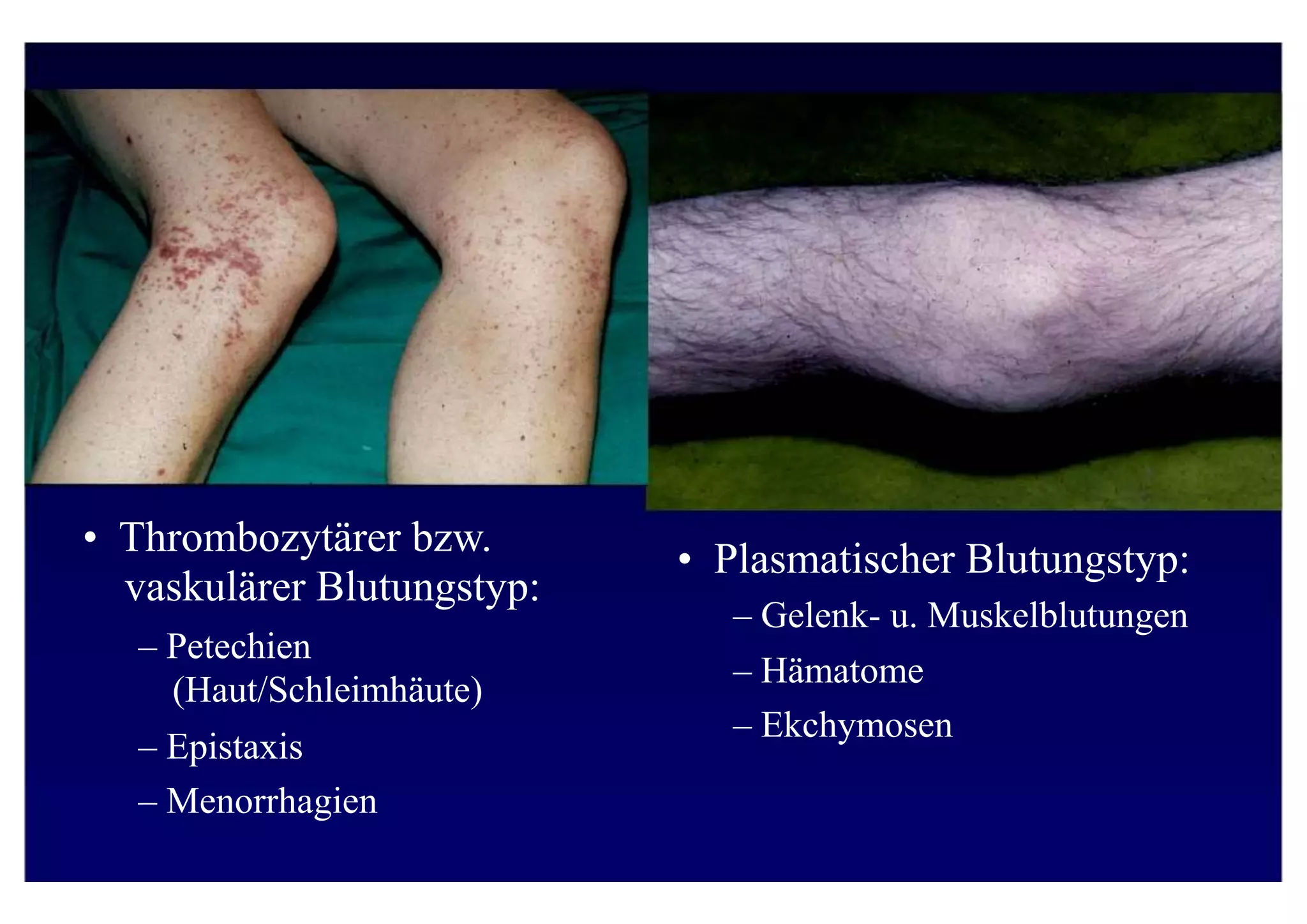 Transfusionsmedizin, Teil 3 ,Transfusion von Blutkonserven. Transfusi…