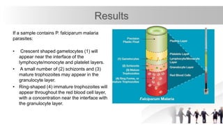 QBC & ELISA Test | PPTX