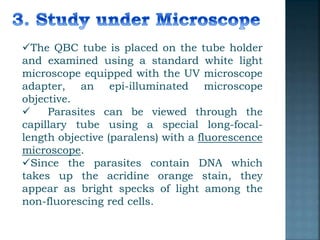 Qbc test | PPTX | Infectious Diseases | Diseases and Conditions