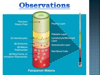 Qbc test | PPTX | Infectious Diseases | Diseases and Conditions