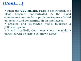 Qbc test | PPTX | Infectious Diseases | Diseases and Conditions