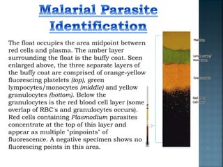 Qbc test | PPTX | Infectious Diseases | Diseases and Conditions