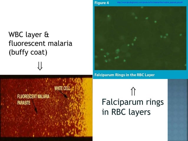 Qbc test | PPTX | Infectious Diseases | Diseases and Conditions