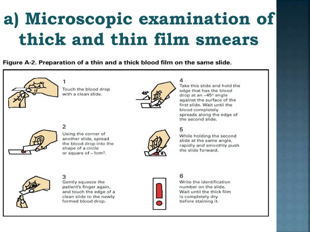 Qbc test | PPTX | Infectious Diseases | Diseases and Conditions