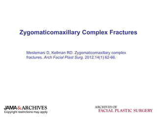 ZYGOMATICOMAXILLARY FRACTURES AND MANAGEMENT | PPT