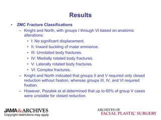 ZYGOMATICOMAXILLARY FRACTURES AND MANAGEMENT | PPT