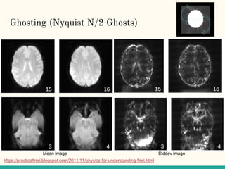 Quality control for structural and functional MRI | PPTX