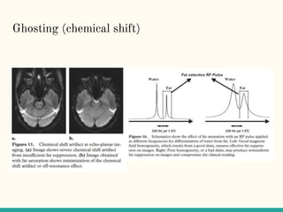 Quality control for structural and functional MRI | PPTX