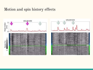 Quality control for structural and functional MRI | PPTX