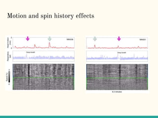 Quality control for structural and functional MRI | PPTX