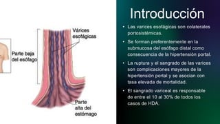 Varices esofágicas -_Ian_Martínez | PPTX