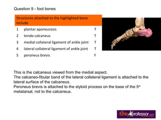 Exam Questions Foot Bones | PPT