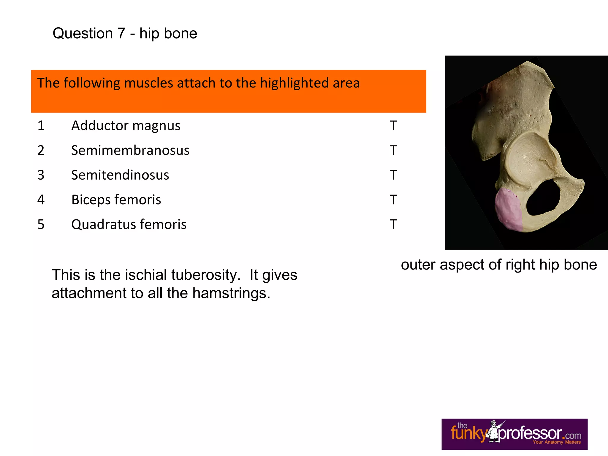 Exam Questions Hip Bone | PPT