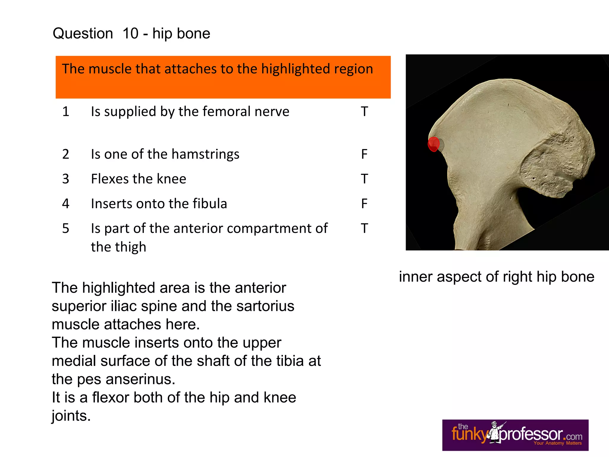 Exam Questions Hip Bone | PPT